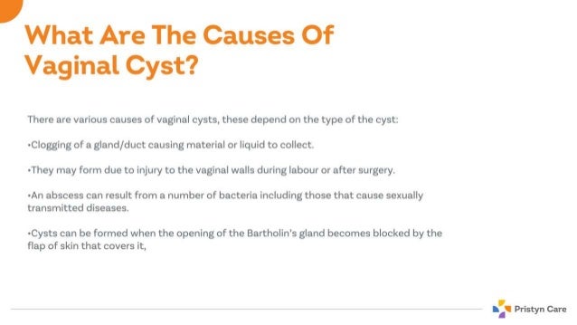 Vaginal Cysts - Causes, Symptoms & Treatment