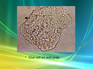 Vaginal discharge | PPT