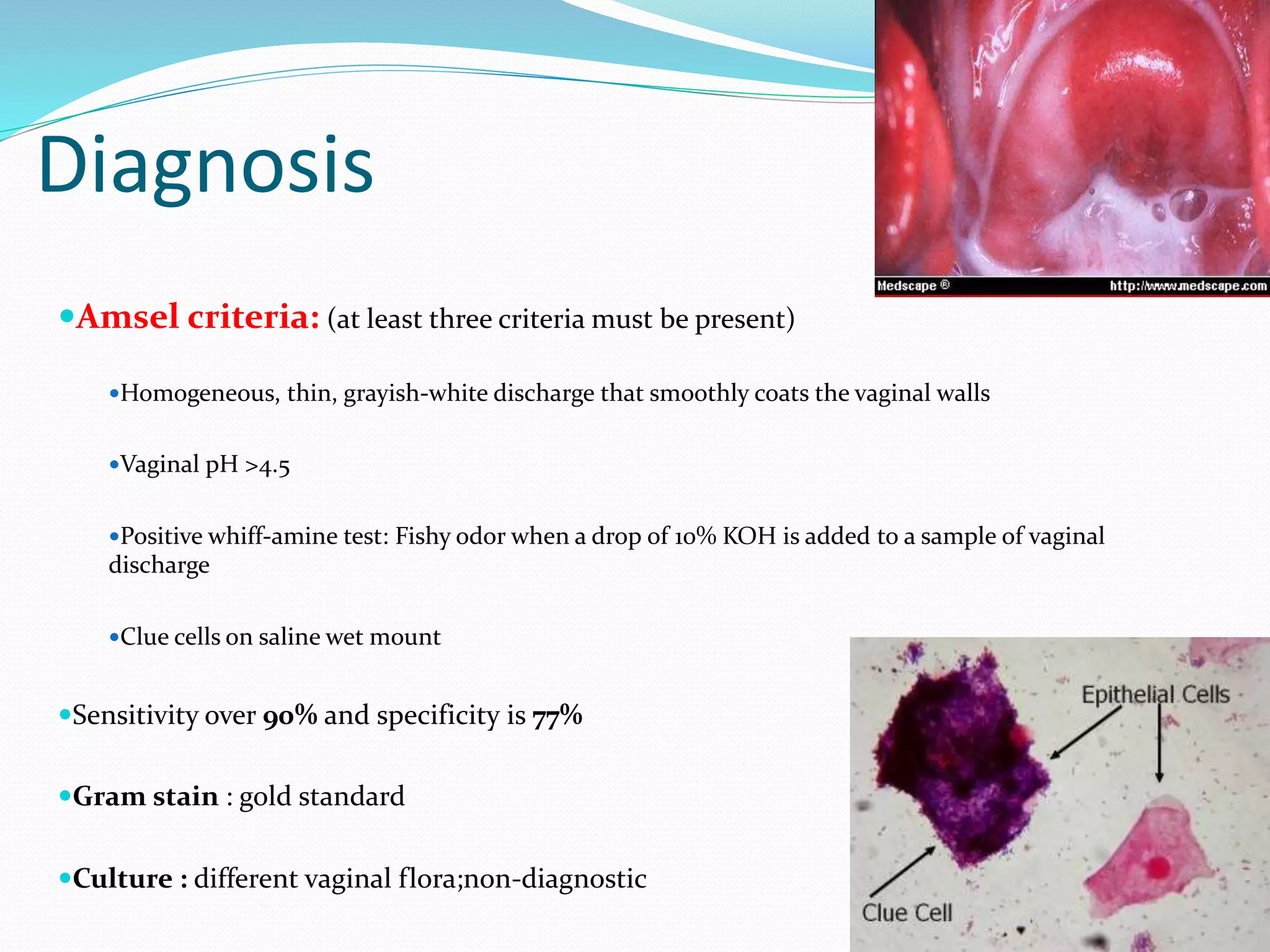 Vaginal Discharge syndrome and general management | PPTX