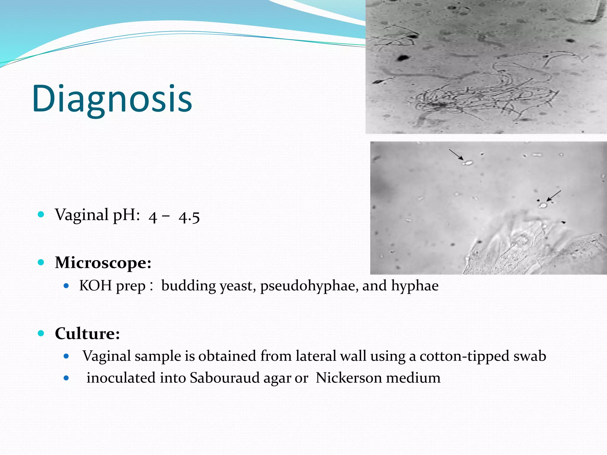 Vaginal Discharge syndrome and general management | PPTX