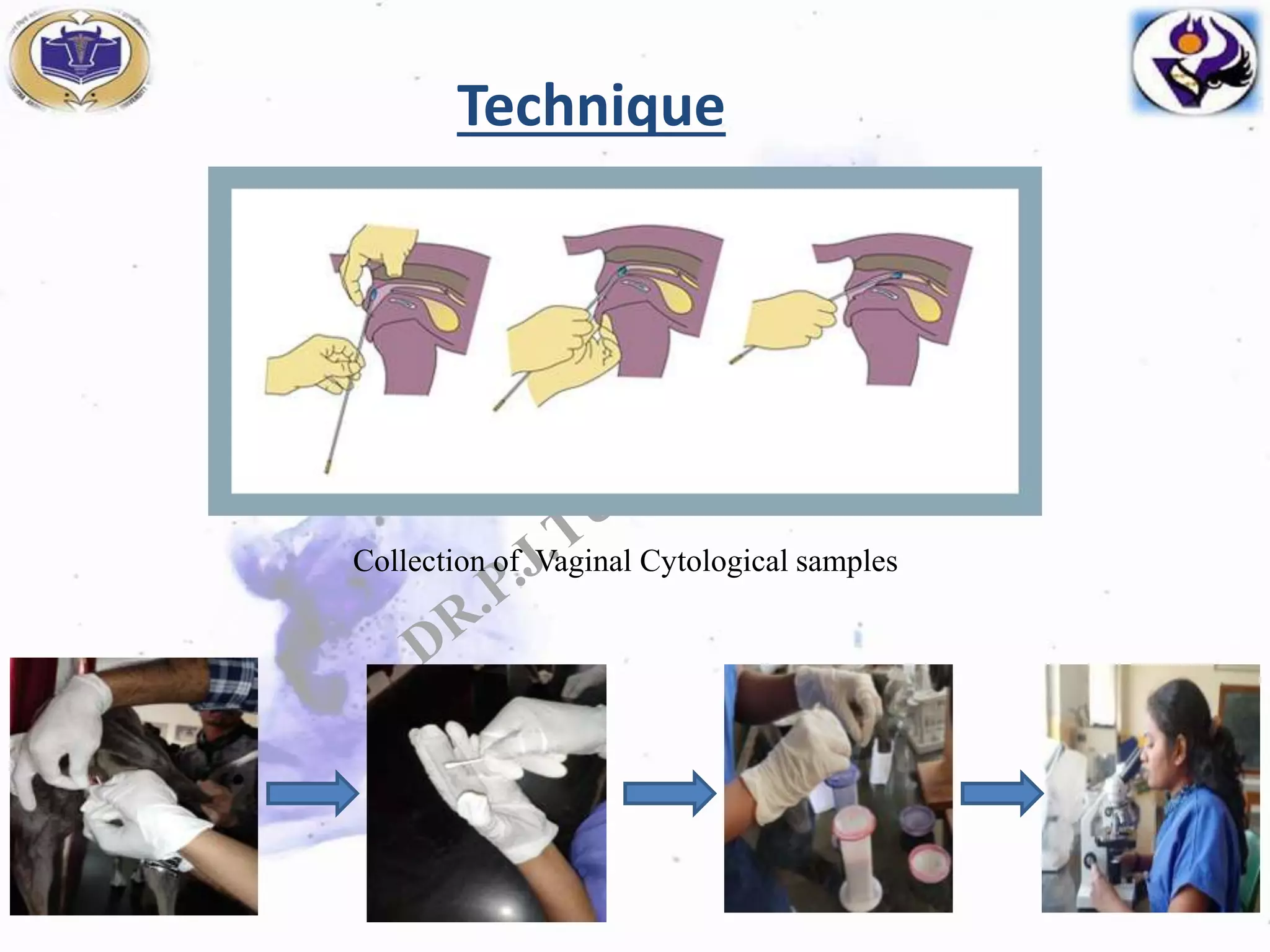 Vaginal exfoliative cytology | PPTX