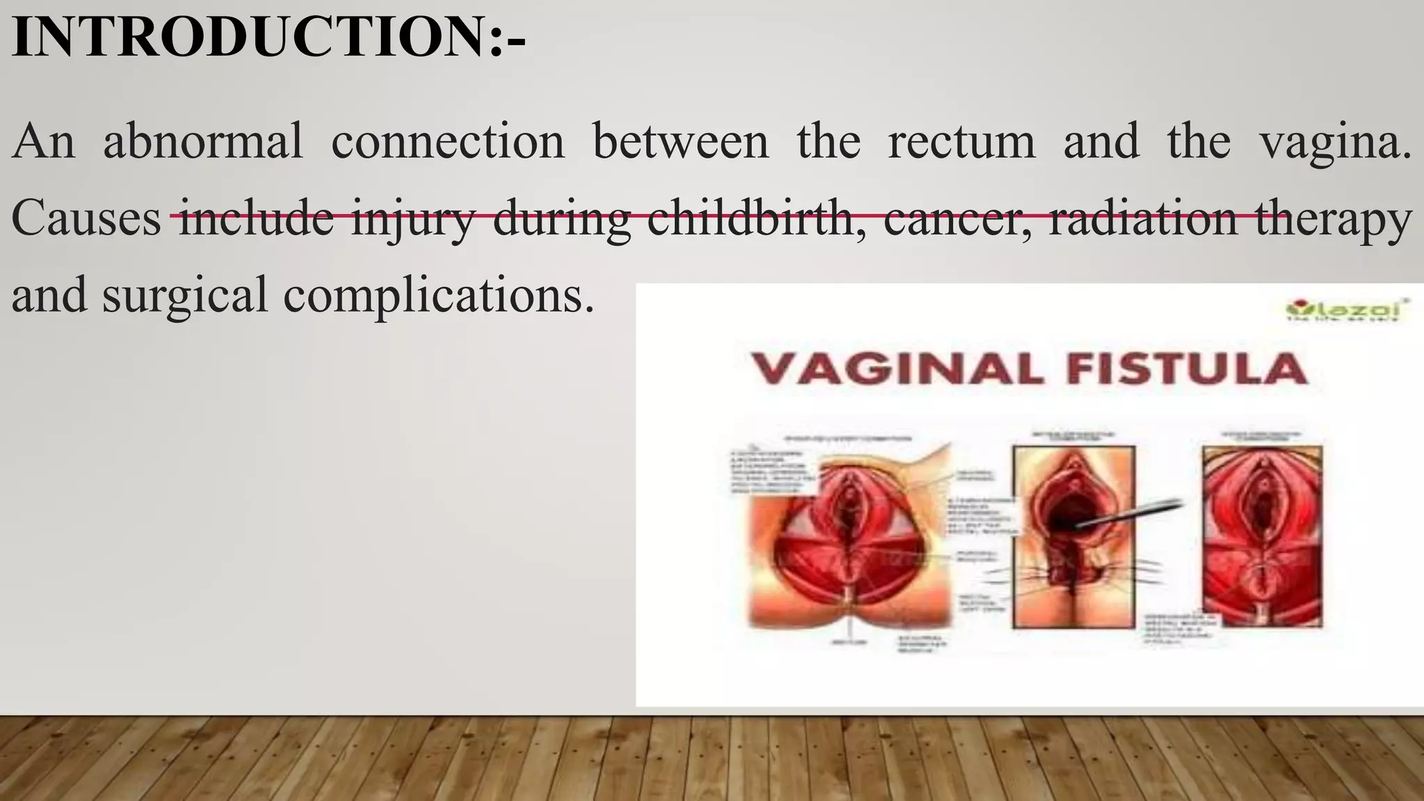 Vaginal fistula (1).pdf