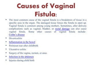 Vaginal Fistula: Causes, Symptoms, Diagnosis, and Treatment | PPTX