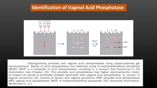 Vaginal Fluid Analysis - Forensic Biology | PPTX