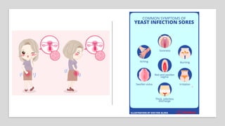 Vaginal Health ppt Women health and wellness ppt | PPTX