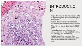 VAGINAL INTRAEPITHELIAL NEOPLASIAAAAAAAA | PPTX