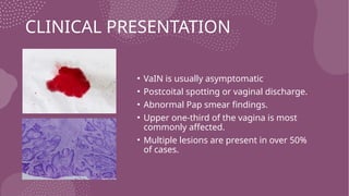 VAGINAL INTRAEPITHELIAL NEOPLASIAAAAAAAA | PPTX