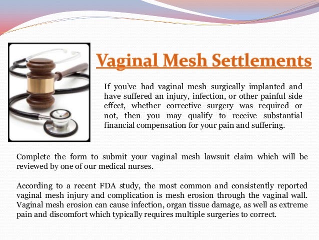 Transvaginal Mesh Lawsuit