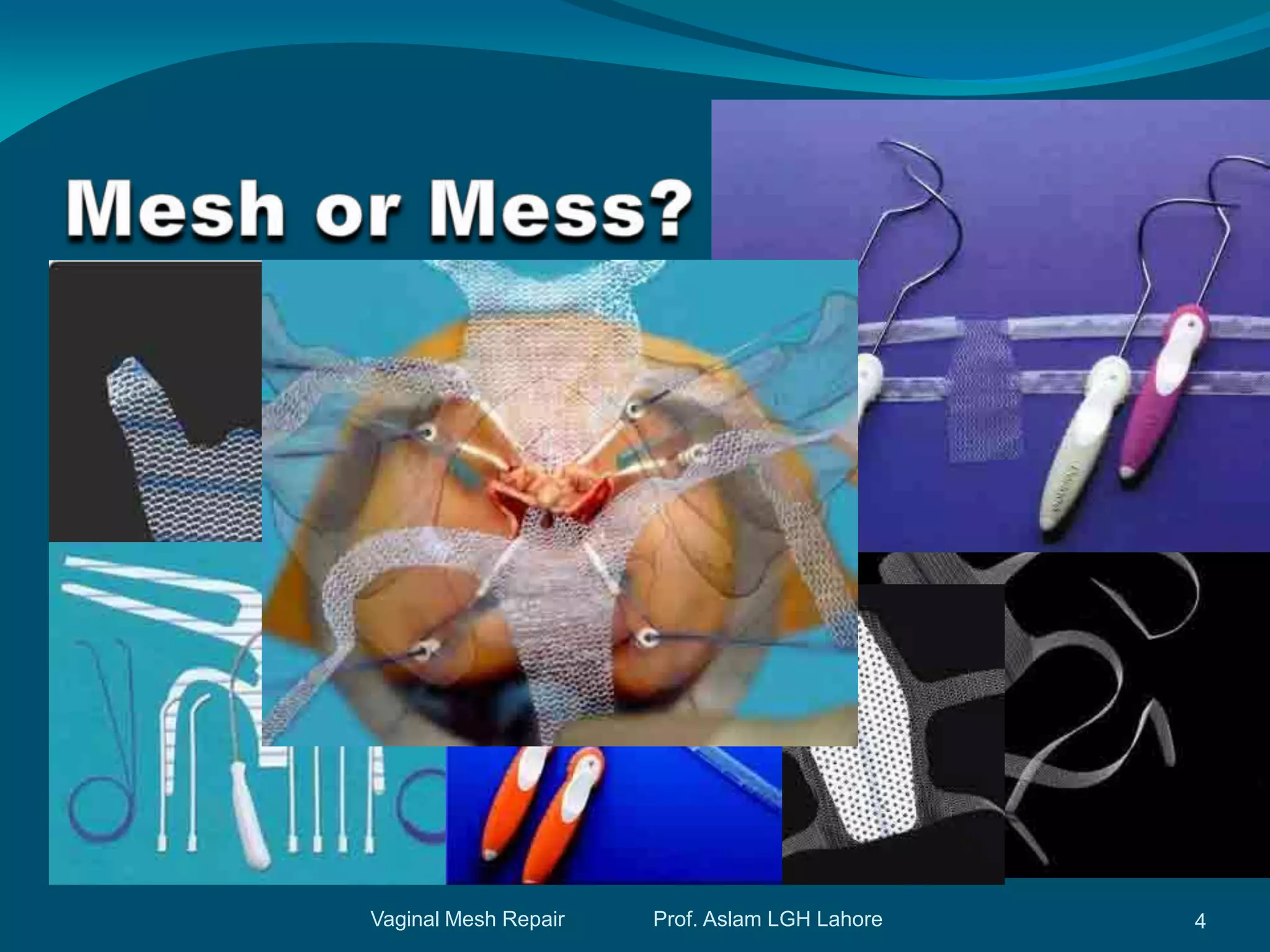 Vaginal mesh repair | PPTX