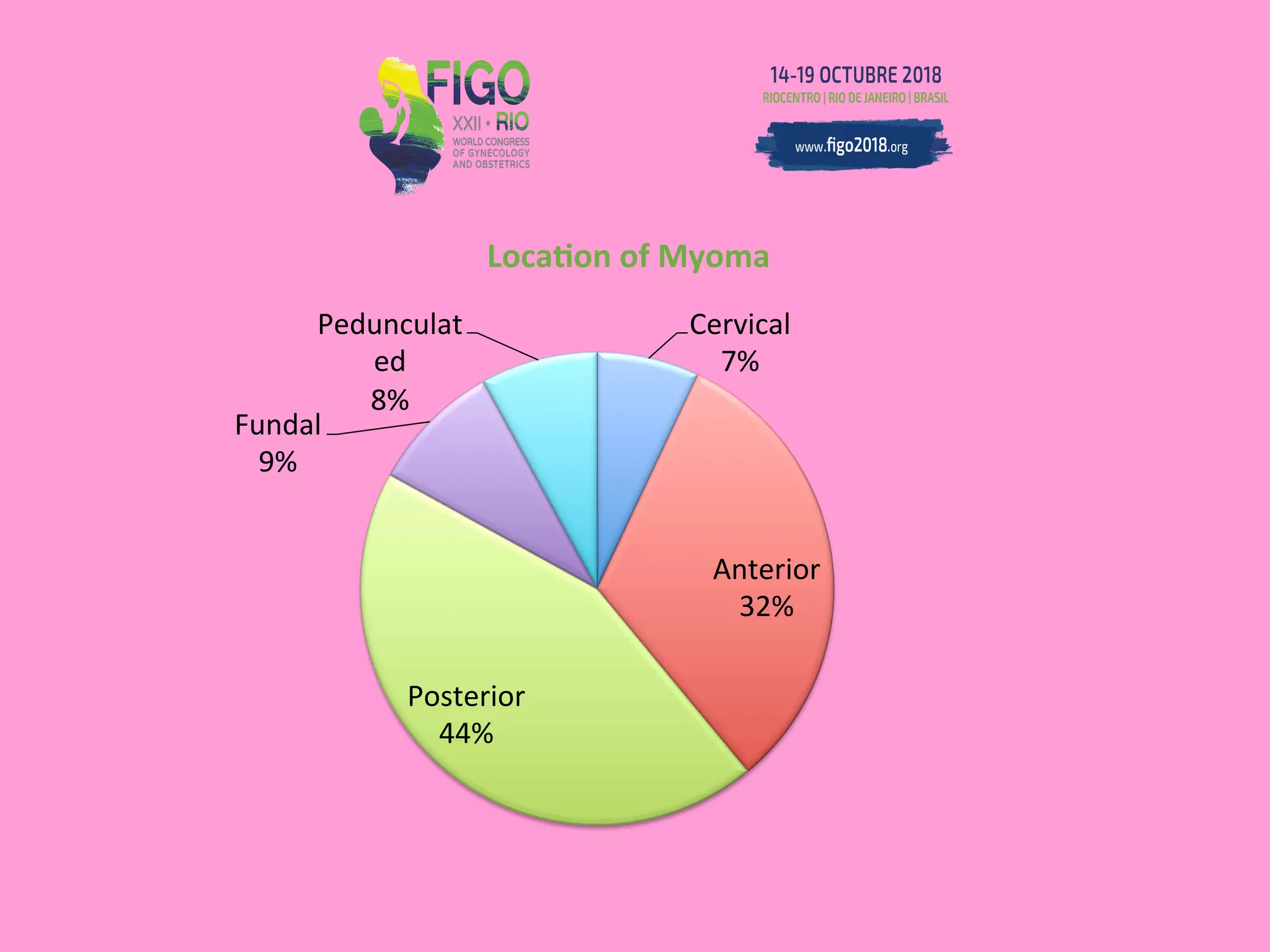 Vaginal myomectomy | PDF