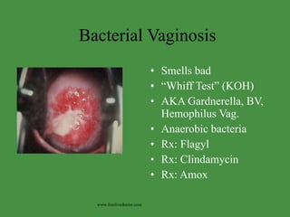 Vaginal prurities | PPT