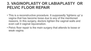 Vaginal rejuvenation | PPTX