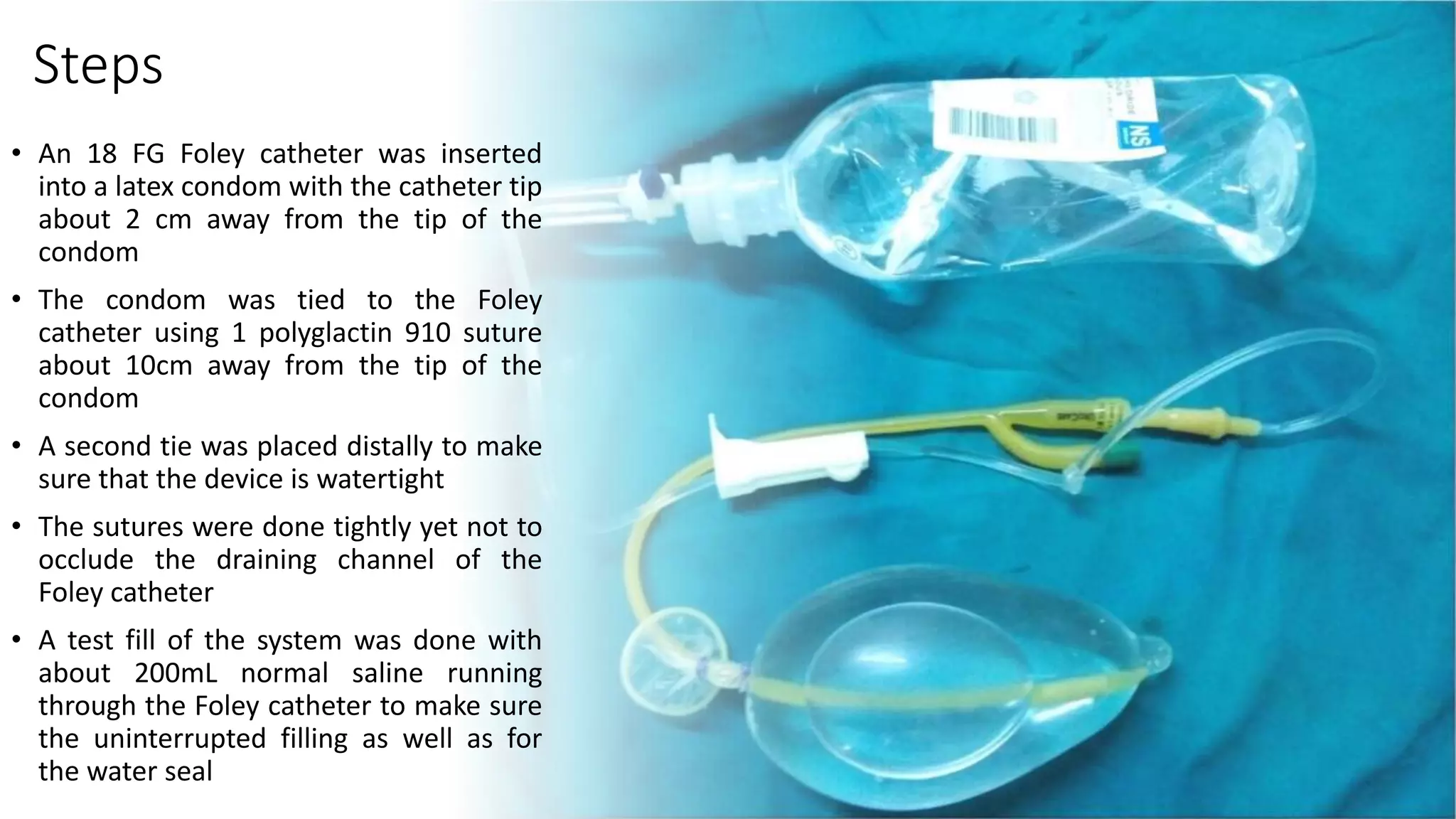 Vaginal tamponade | PPTX