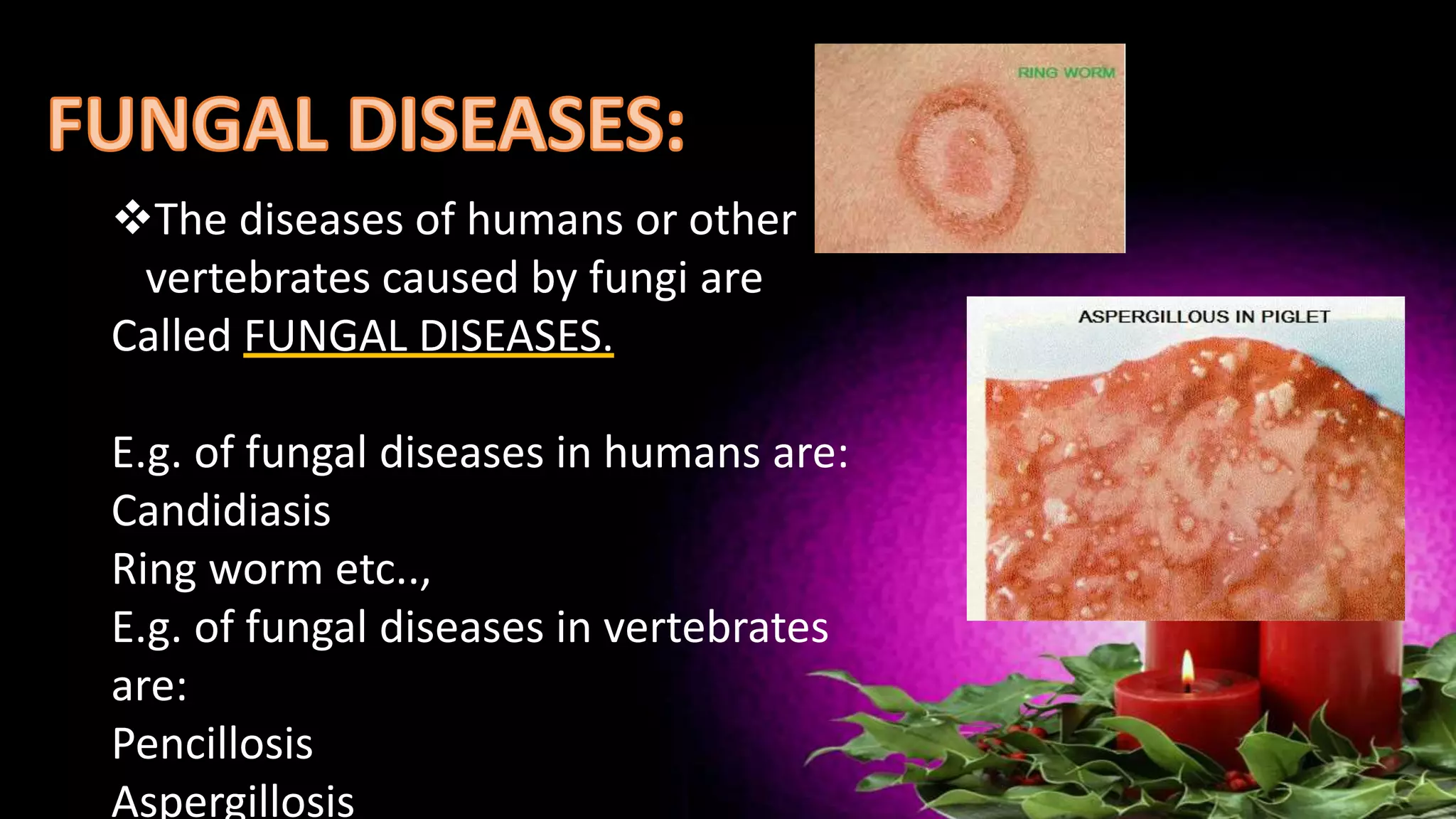 Vaginal thrush | PPTX