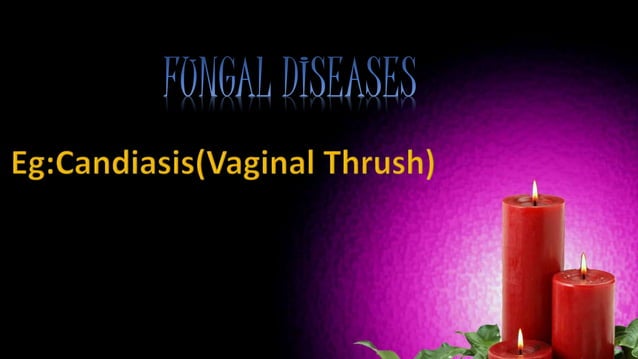 Vaginal thrush | PPTX | Skin and Dermatology | Diseases and Conditions