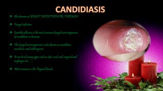Vaginal thrush | PPTX
