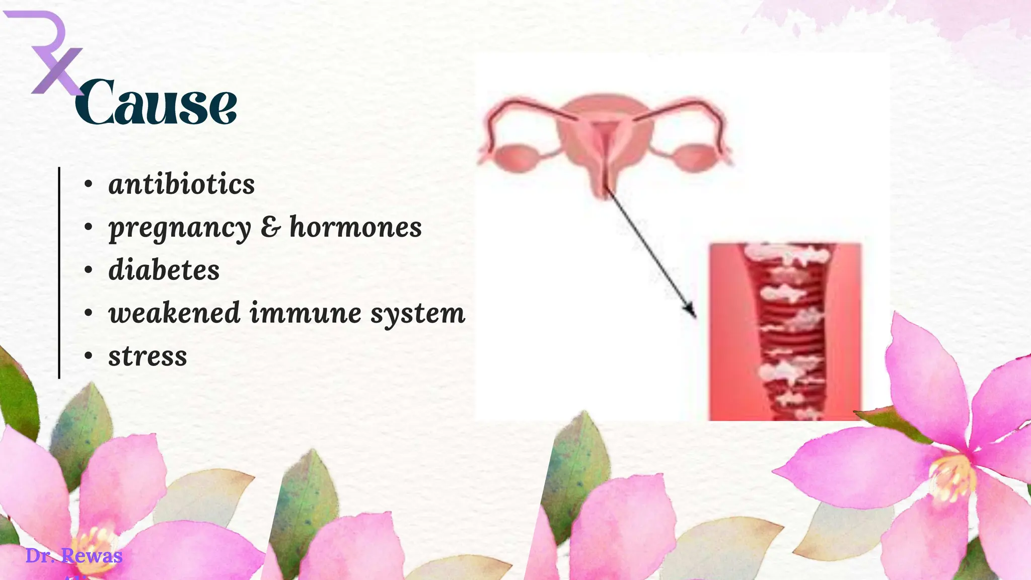 vaginal thrush presentation by Dr. Rewas Ali | PPTX