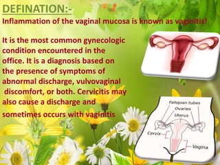 Vaginitis/Colpitis | PPTX