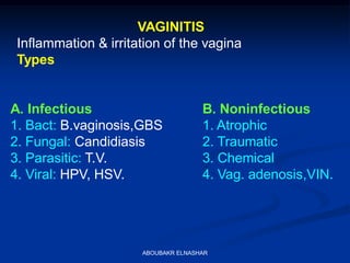Vaginitis | PDF
