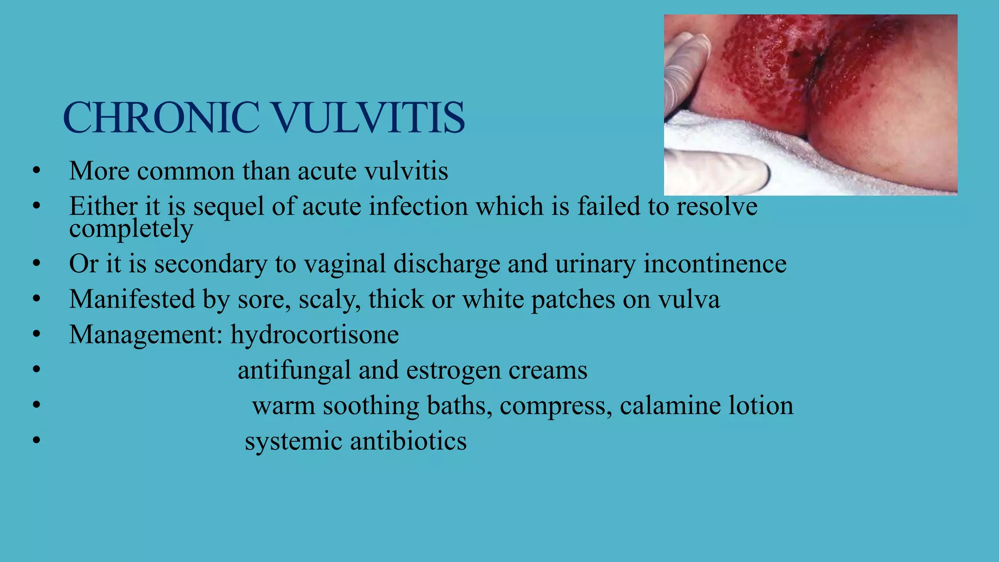 Vaginitis | PPTX