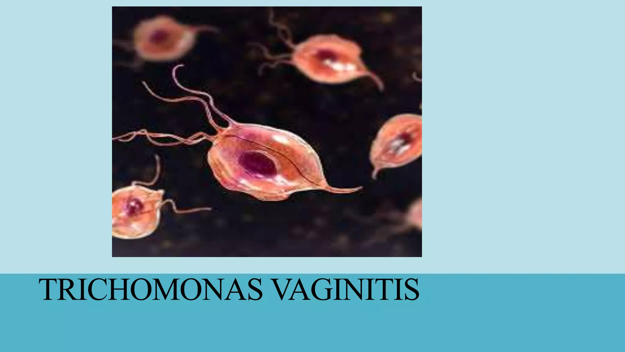 Vaginitis | PPTX