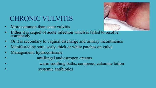 Vaginitis | PPTX | Sexual Conditions | Sexual Health
