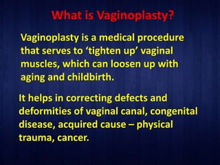 Vaginoplasty | PPTX