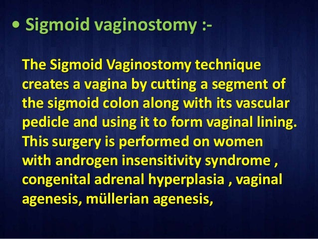 Vaginoplasty