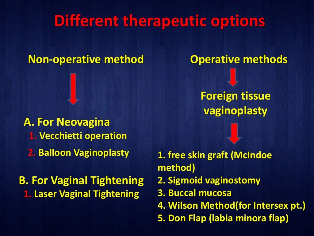 Vaginoplasty