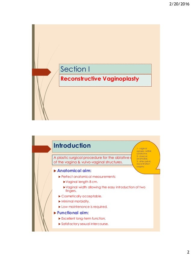 Vaginoplasty An Update And Future Concern