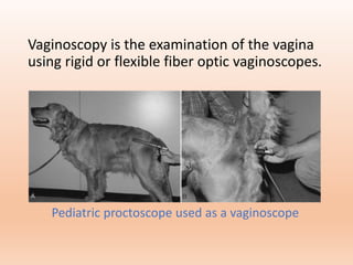 Vaginoscopy | PPTX