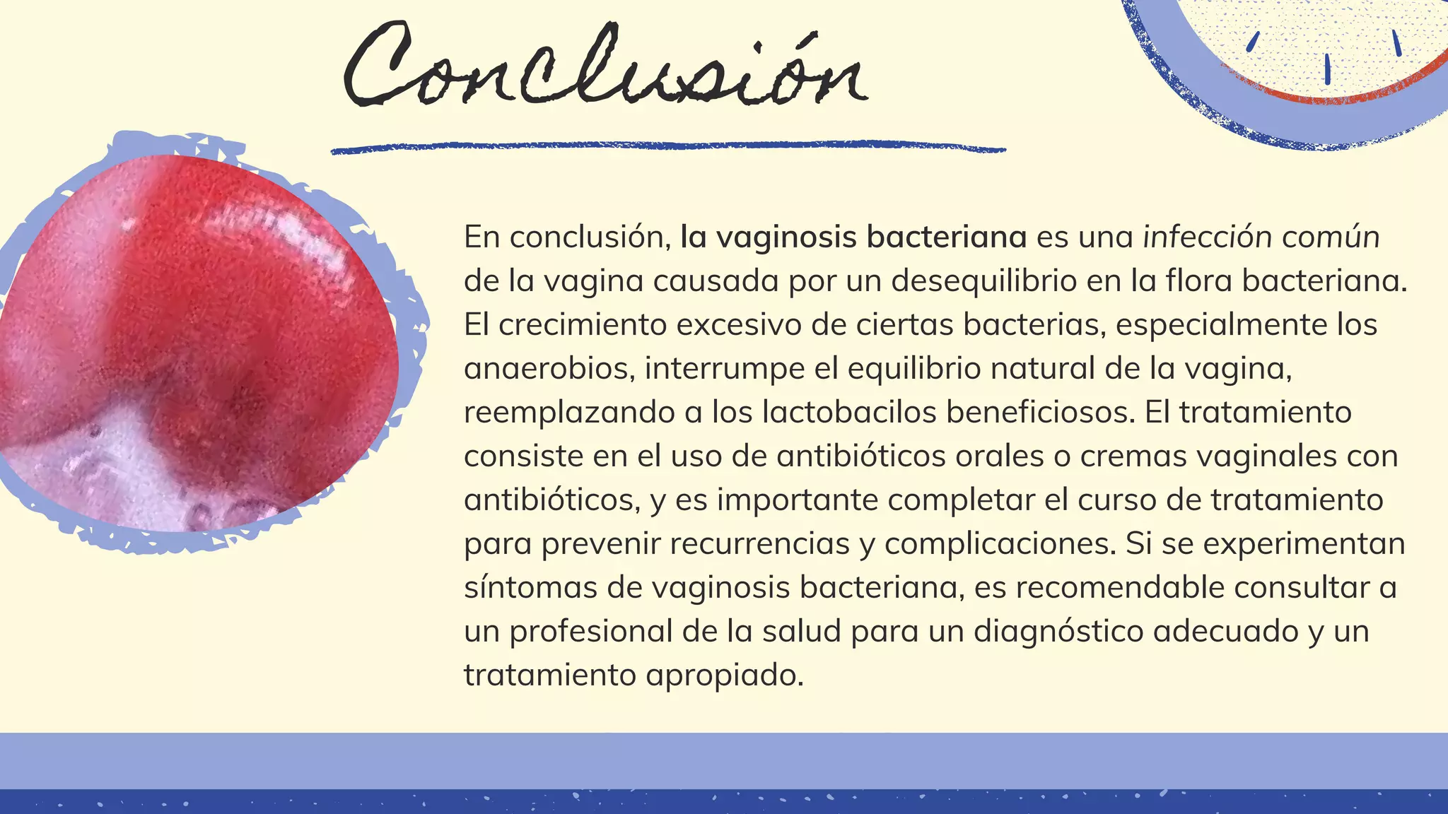 Vaginosis bacteriana | PDF | Sexual Health | Diseases and Conditions