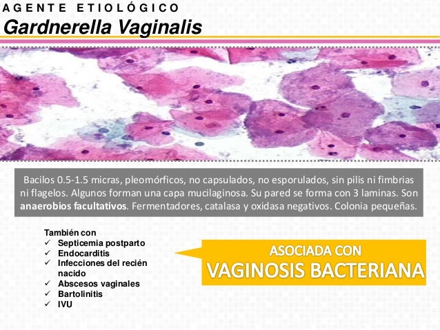 Vaginosis por gardnerella