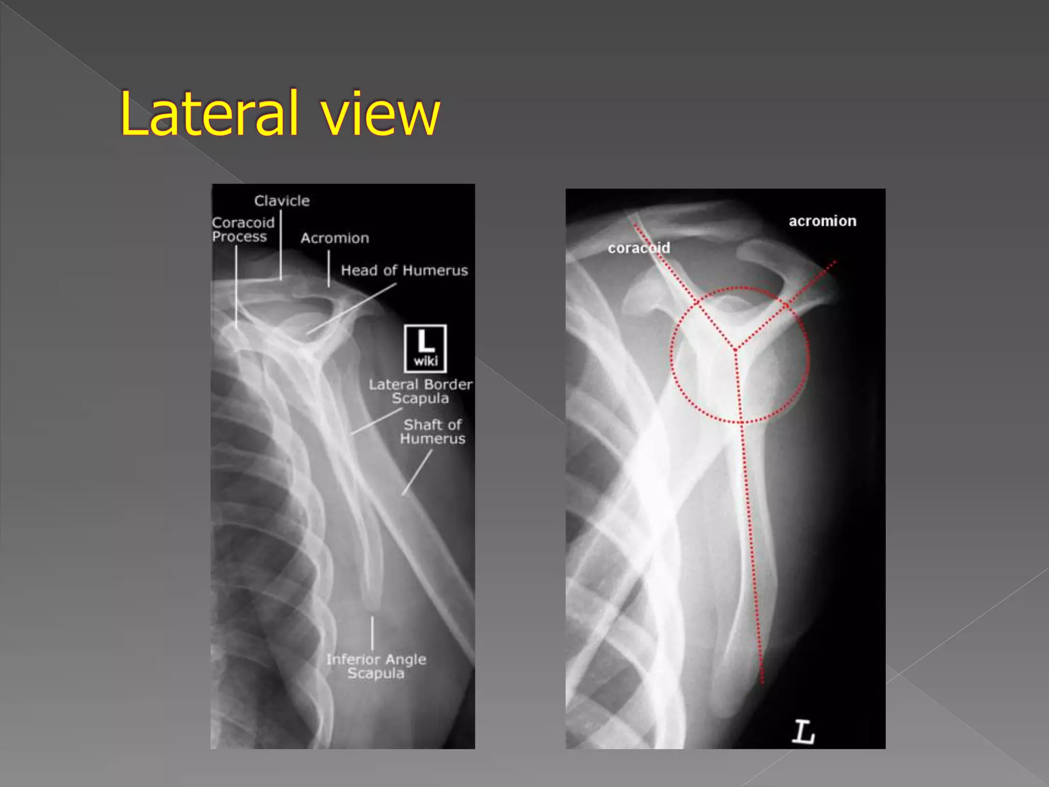 Shoulder x-ray | PPTX