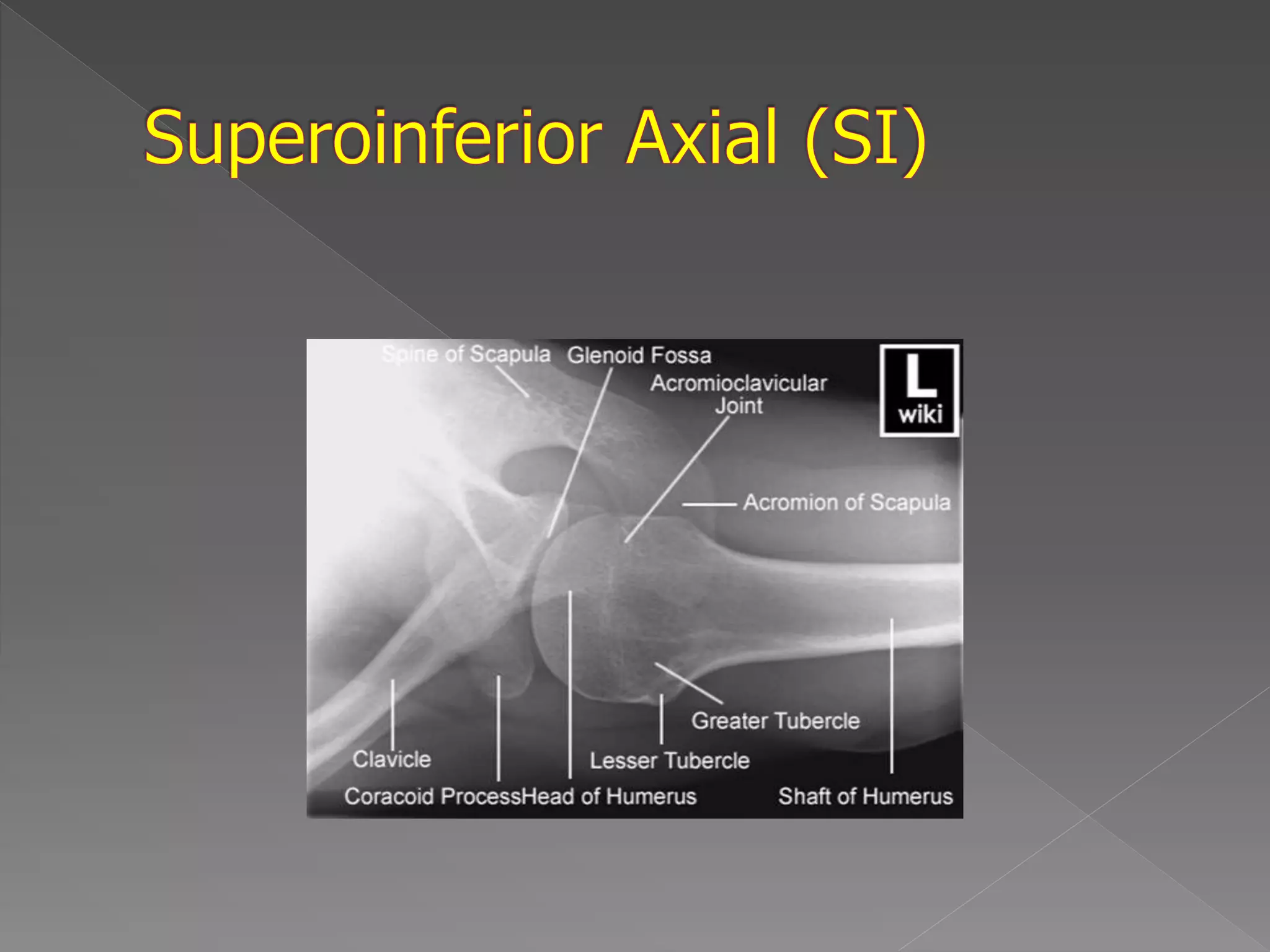 Shoulder x-ray | PPTX