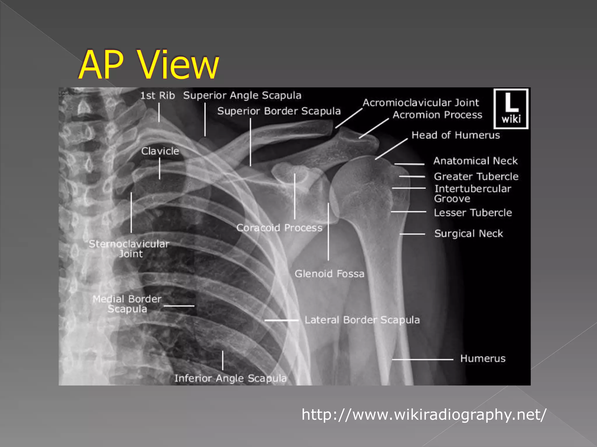 Shoulder x-ray | PPTX