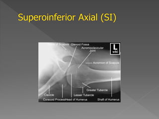 Shoulder x-ray | PPTX