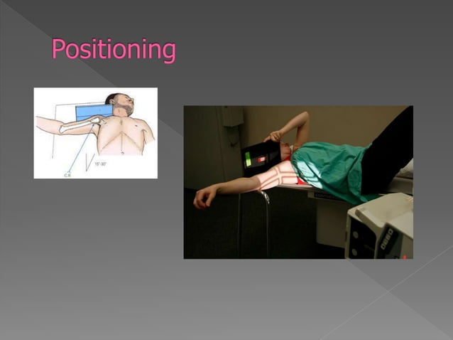 Shoulder x-ray | PPTX | Death, Injury, or Military Conflict | Sensitive ...