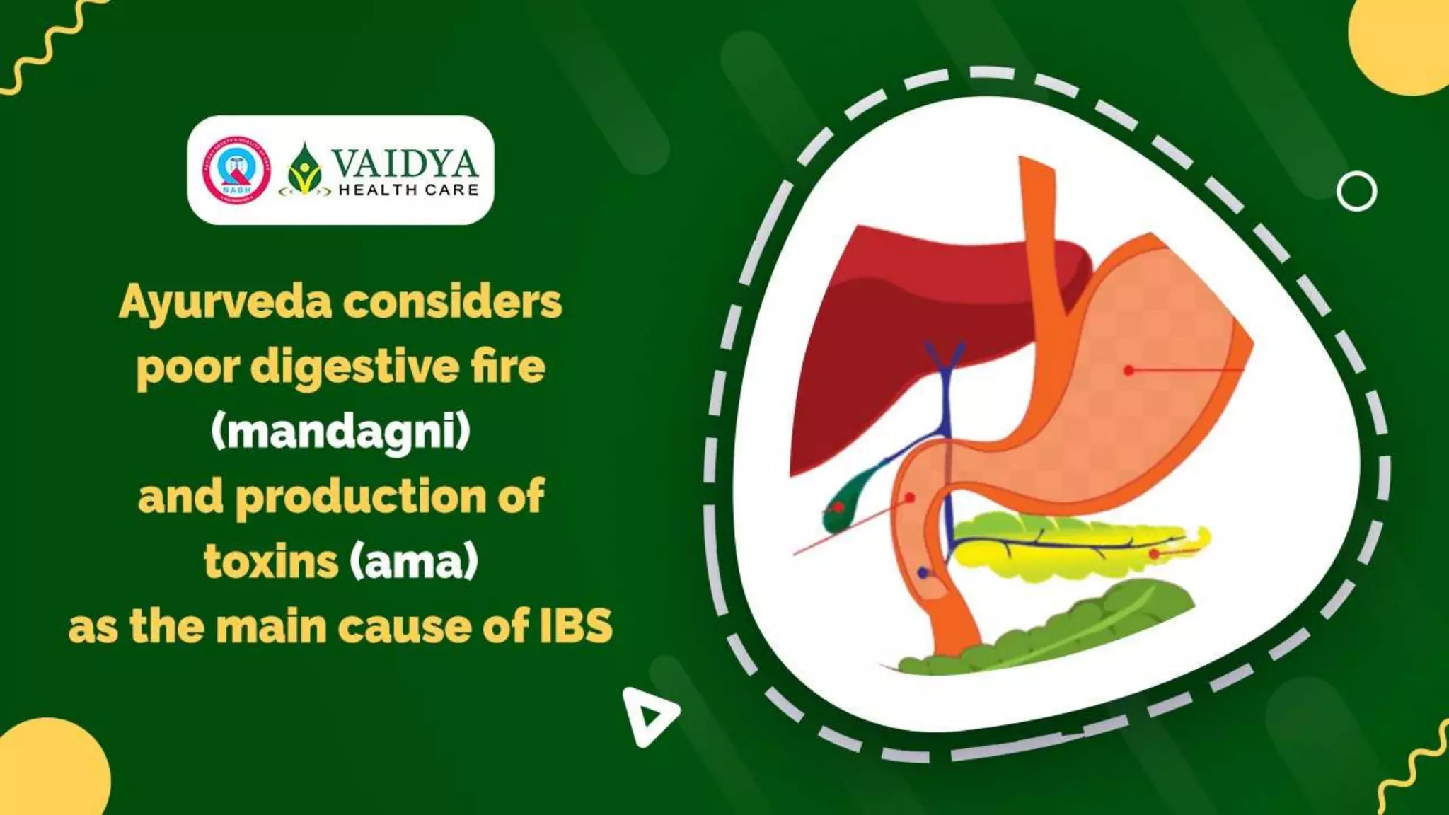 Irritable bowel syndrome (IBS) | PPTX