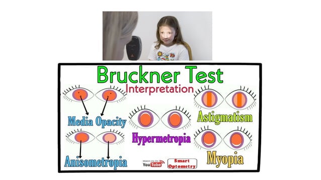Visual Acuity assessment in children.pptx