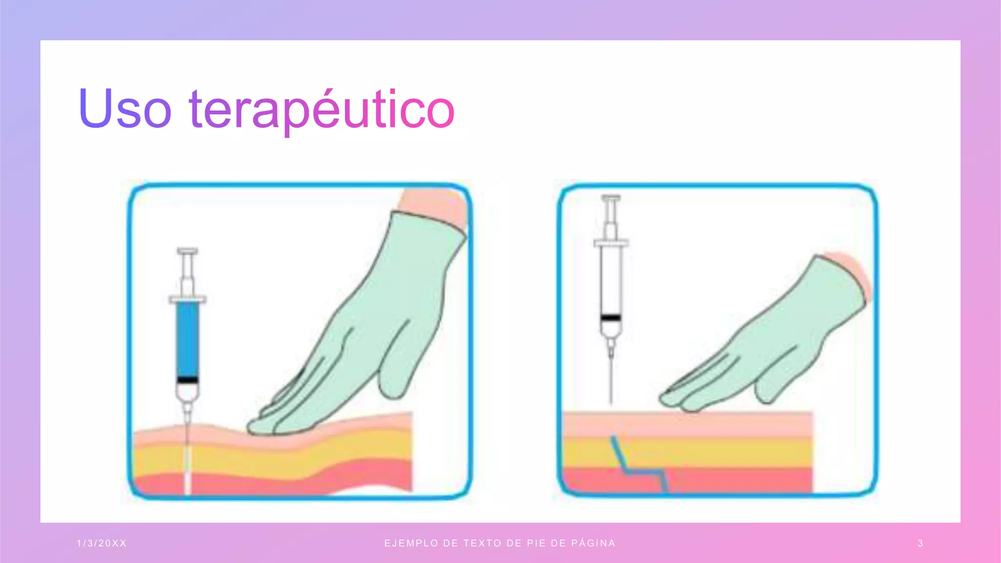 Vía intramuscular.pptx
