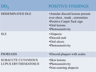 Case of SLE | PPTX | Skin and Dermatology | Diseases and Conditions