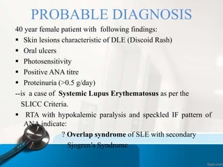 Case of SLE | PPTX | Skin and Dermatology | Diseases and Conditions