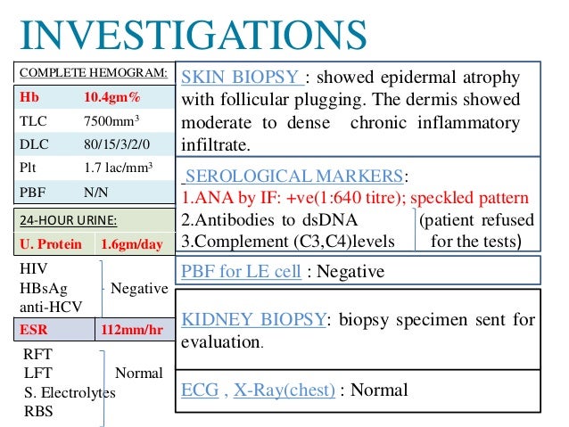Case of SLE
