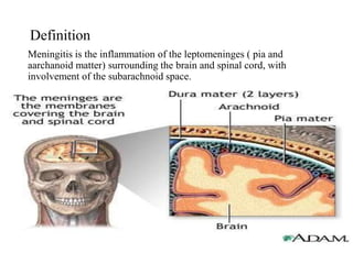 meningitis | PPTX