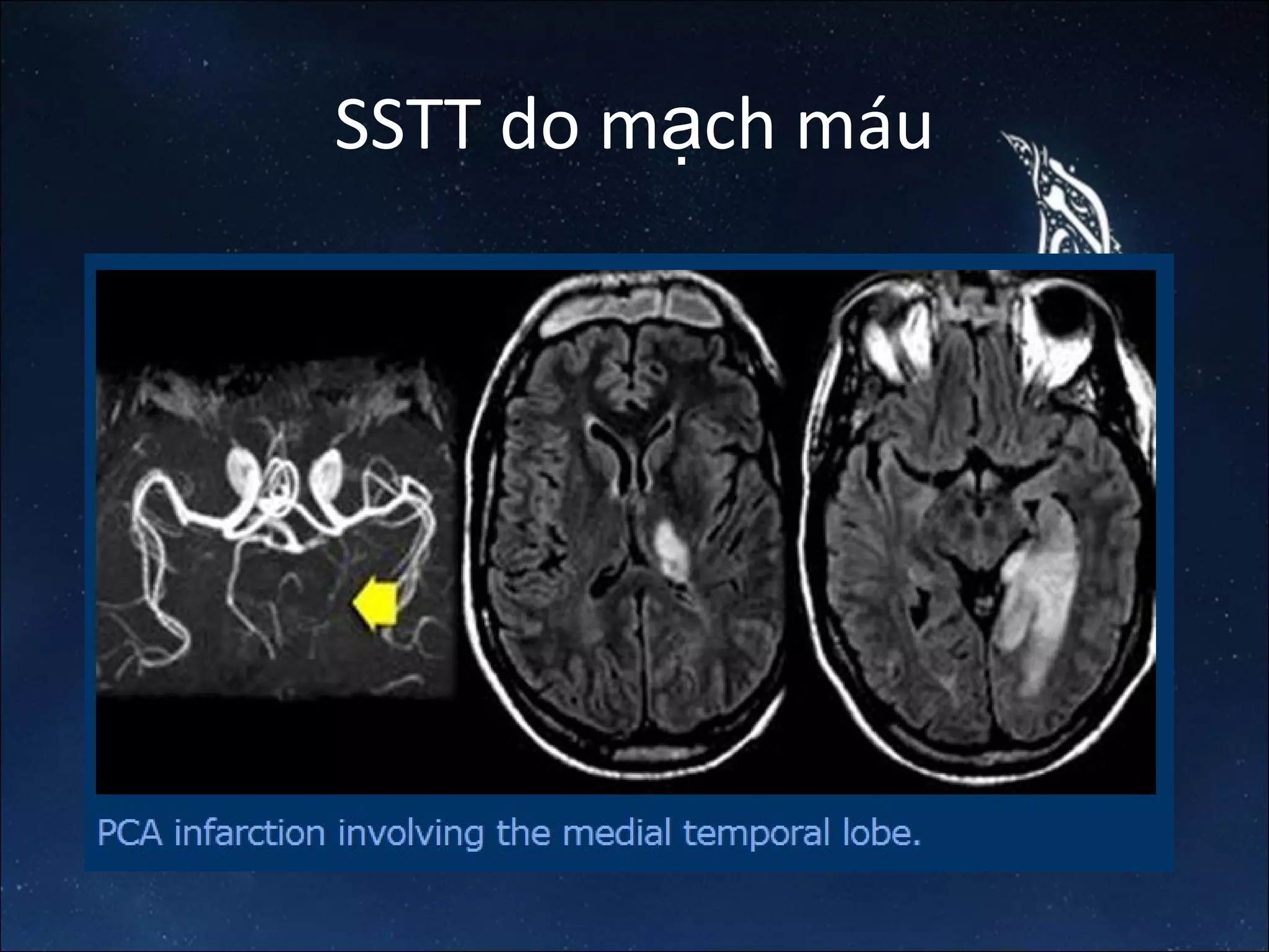 Vai trò cht trong sstt | PPT