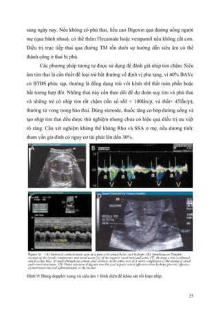 Vai tro satt trong btbs | PDF