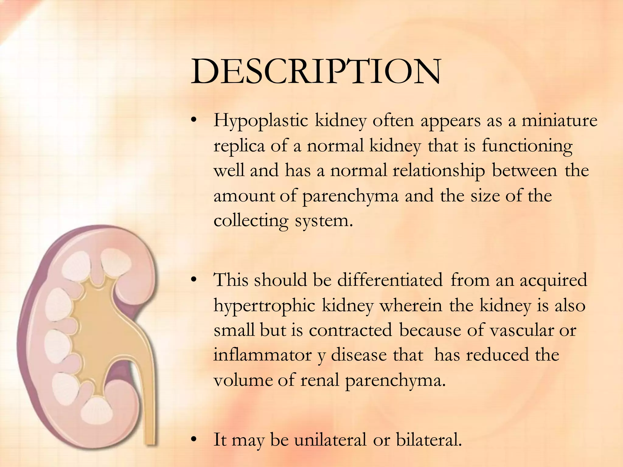 Renal Hypoplasia FINAL OUTPUT by Nica Valencia | PDF