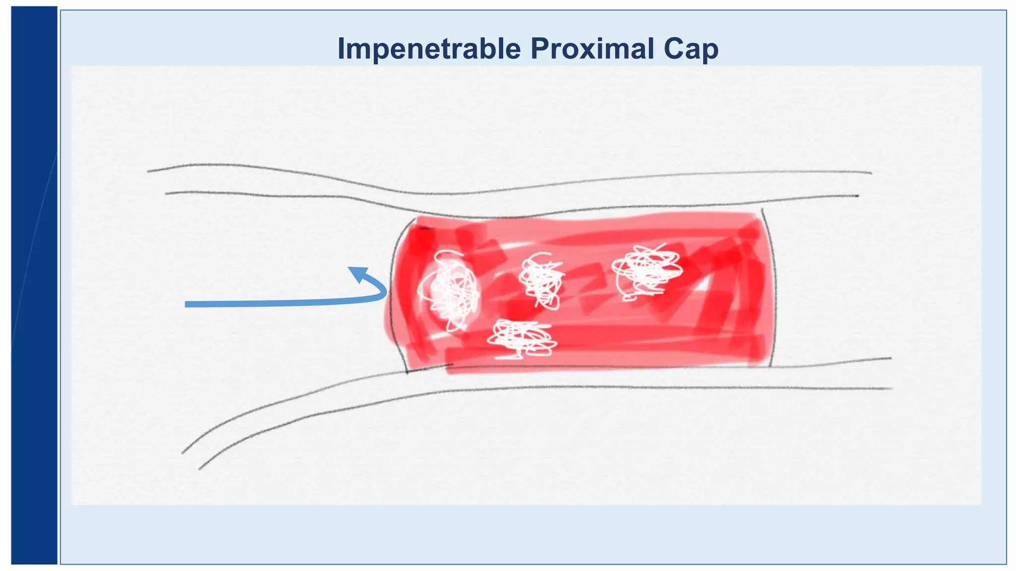 Rapid fire Tipps and Tricks – 5 min: What do do if ... you cannot cross ...