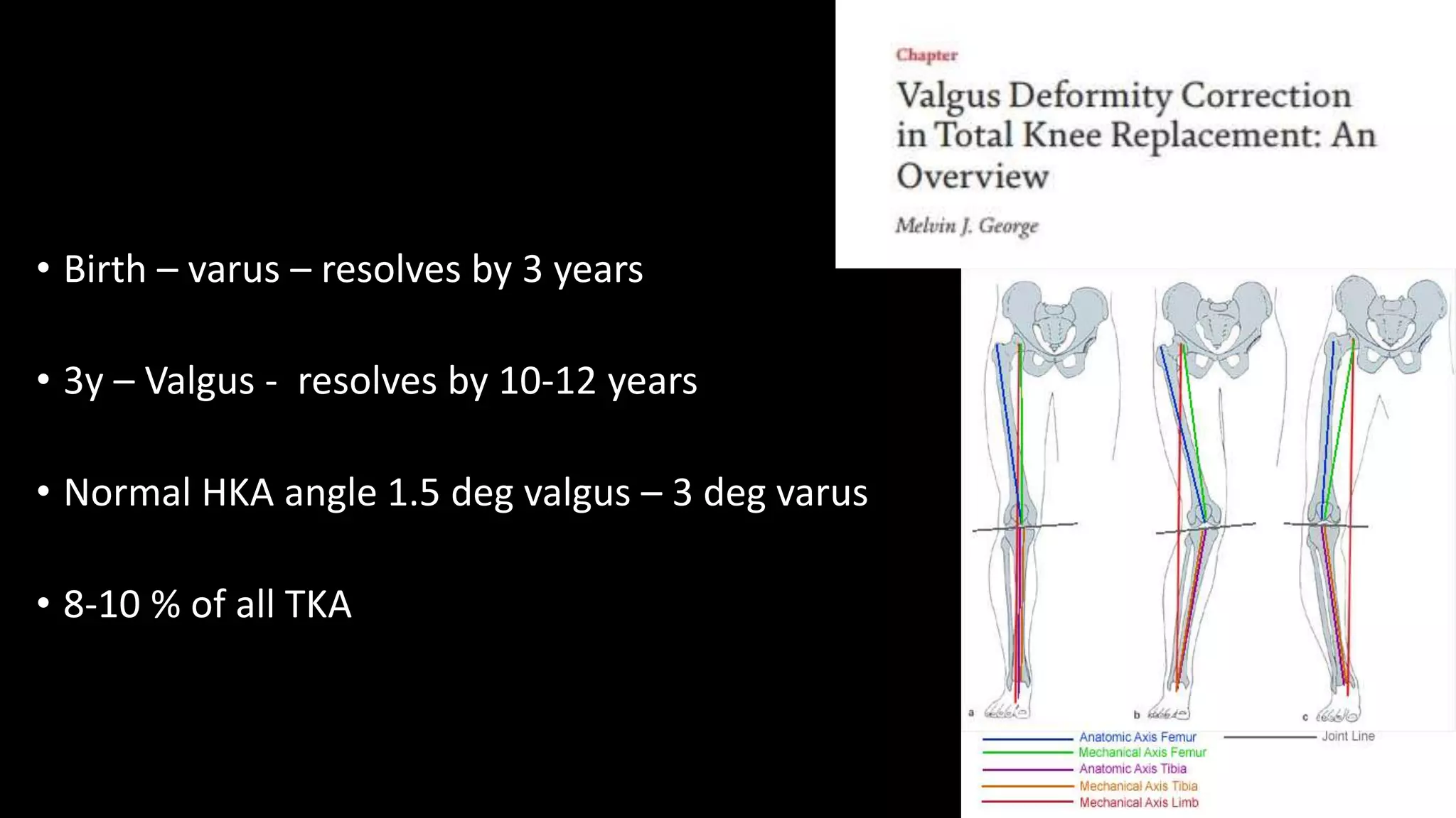 Valgus total knee arthroplasty | PPTX